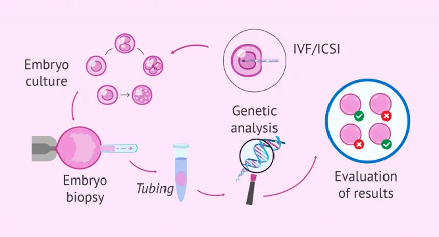 PGD Treatment South Delhi | Genetic Testing with IVF at Medfemme